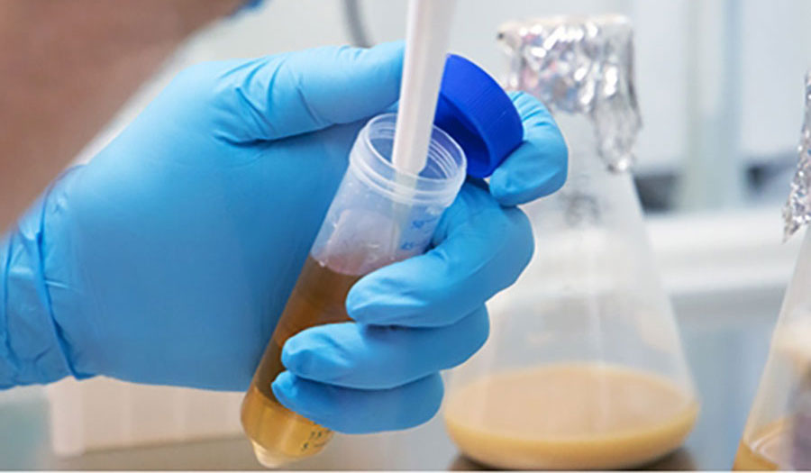 Beer Basics: Yeast Part I - The Crafty Pint